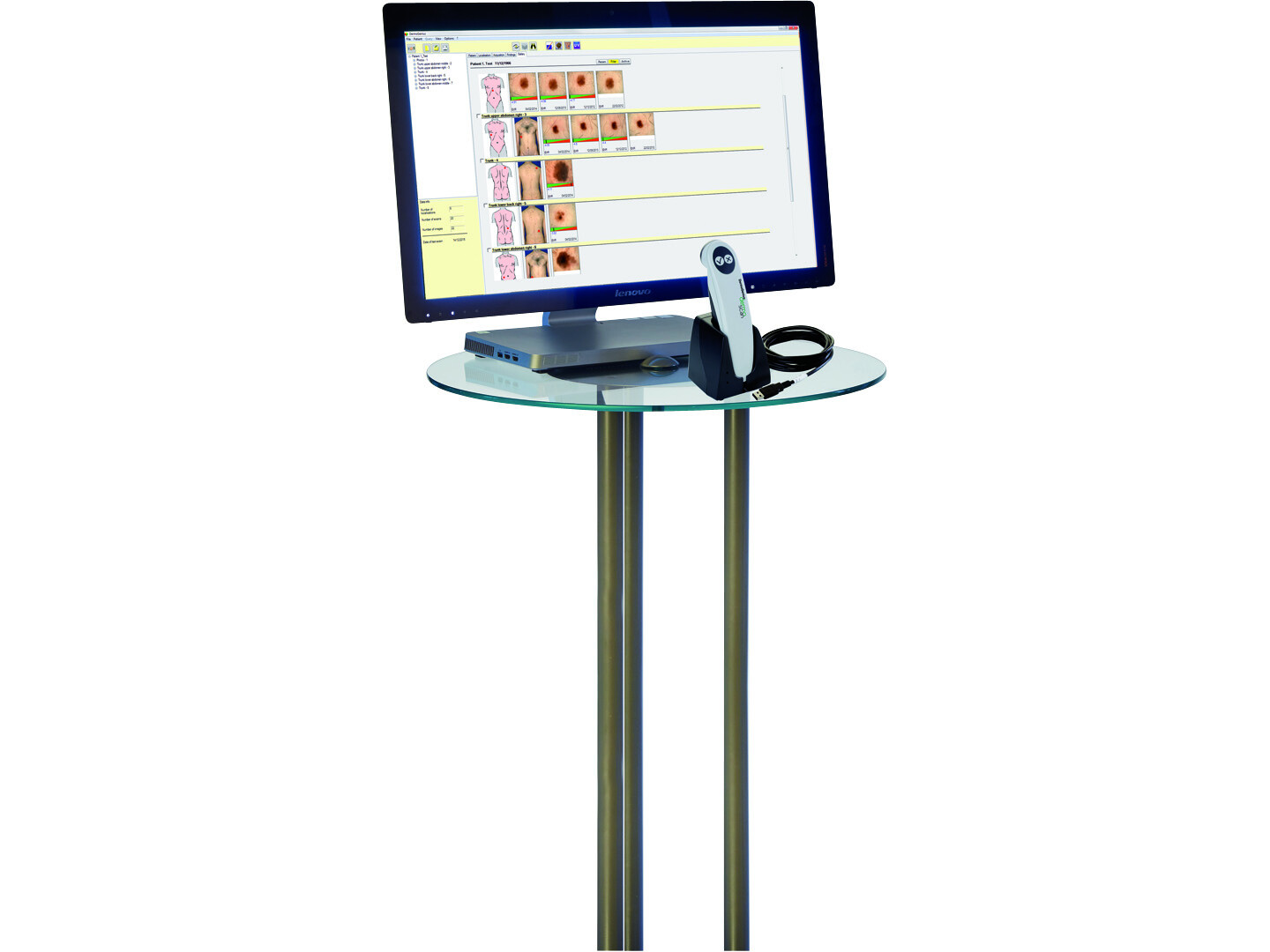 Dermatoskop a celotělový skener - Medicom